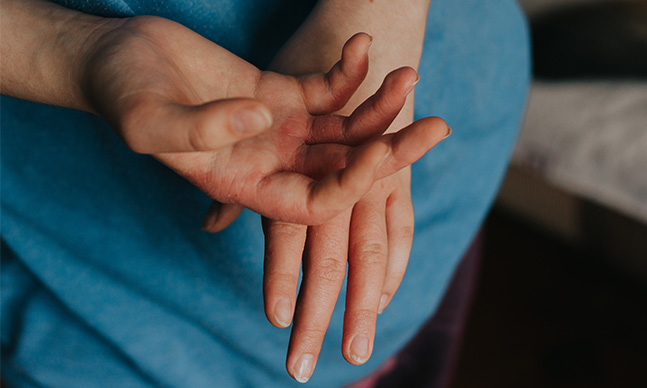 Sarna humana ou escabiose: conheça esta doença de pele