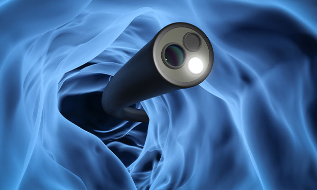 Colonoscopia: como se faz e quais as vantagens