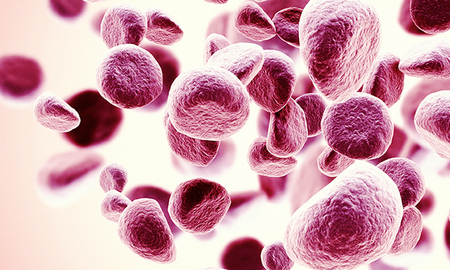 Mieloma múltiplo: o que é?