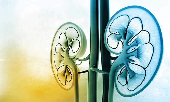 Nefropatia diabética: o que é?